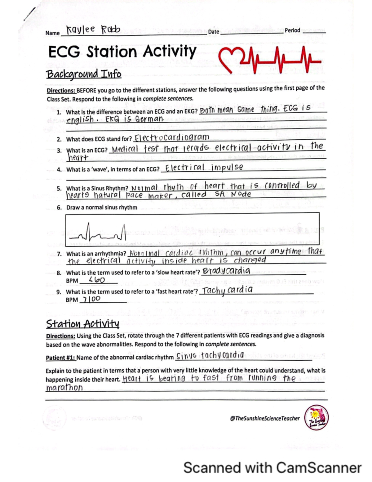 ECG Activity Worksheet: Understanding Heart Rhythms and Diagnoses - Studocu