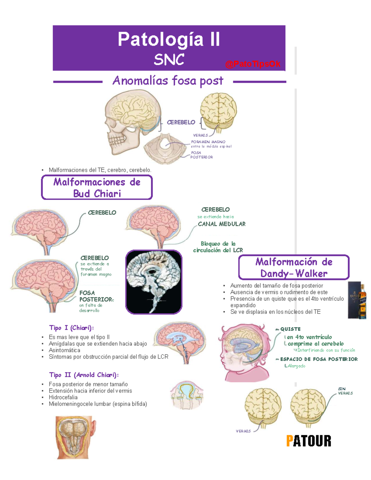 FOSA Posterior: Anomalías del SNC y Malformaciones del Vermis - Studocu