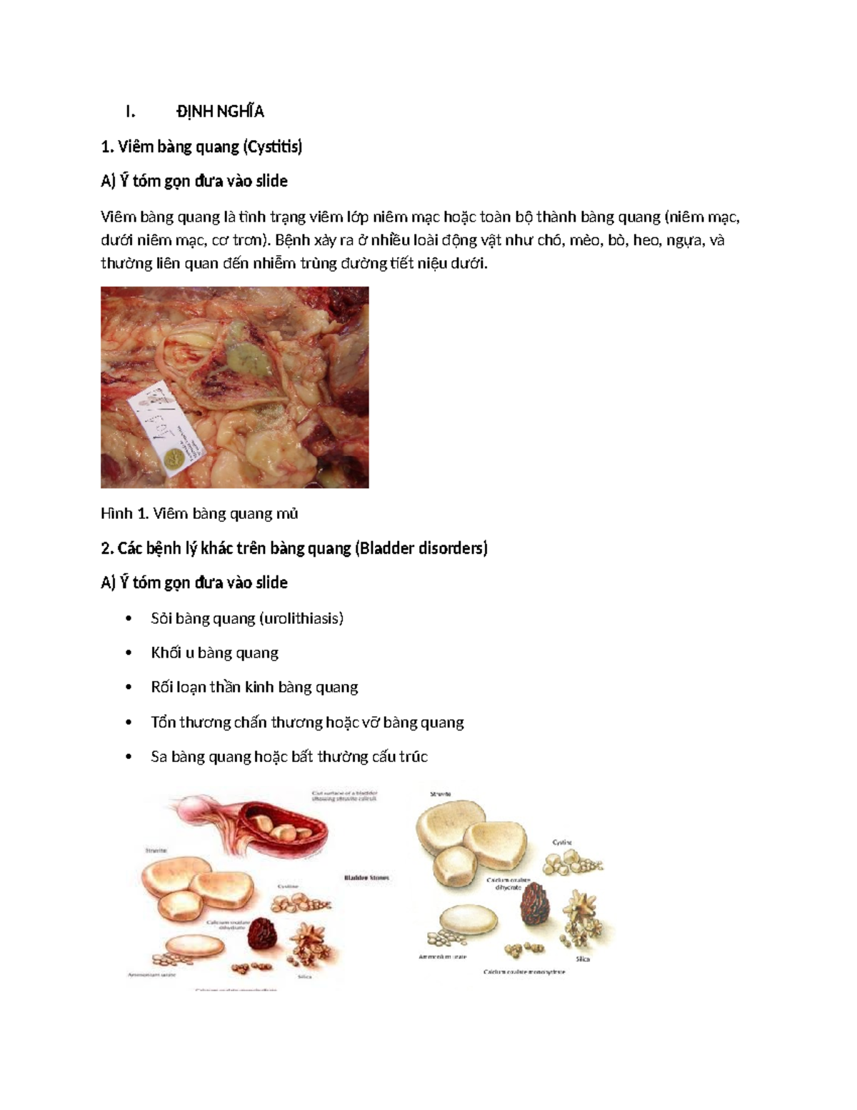 Viêm bàng quang (Cystitis) và các bệnh lý bàng quang khác - Studocu