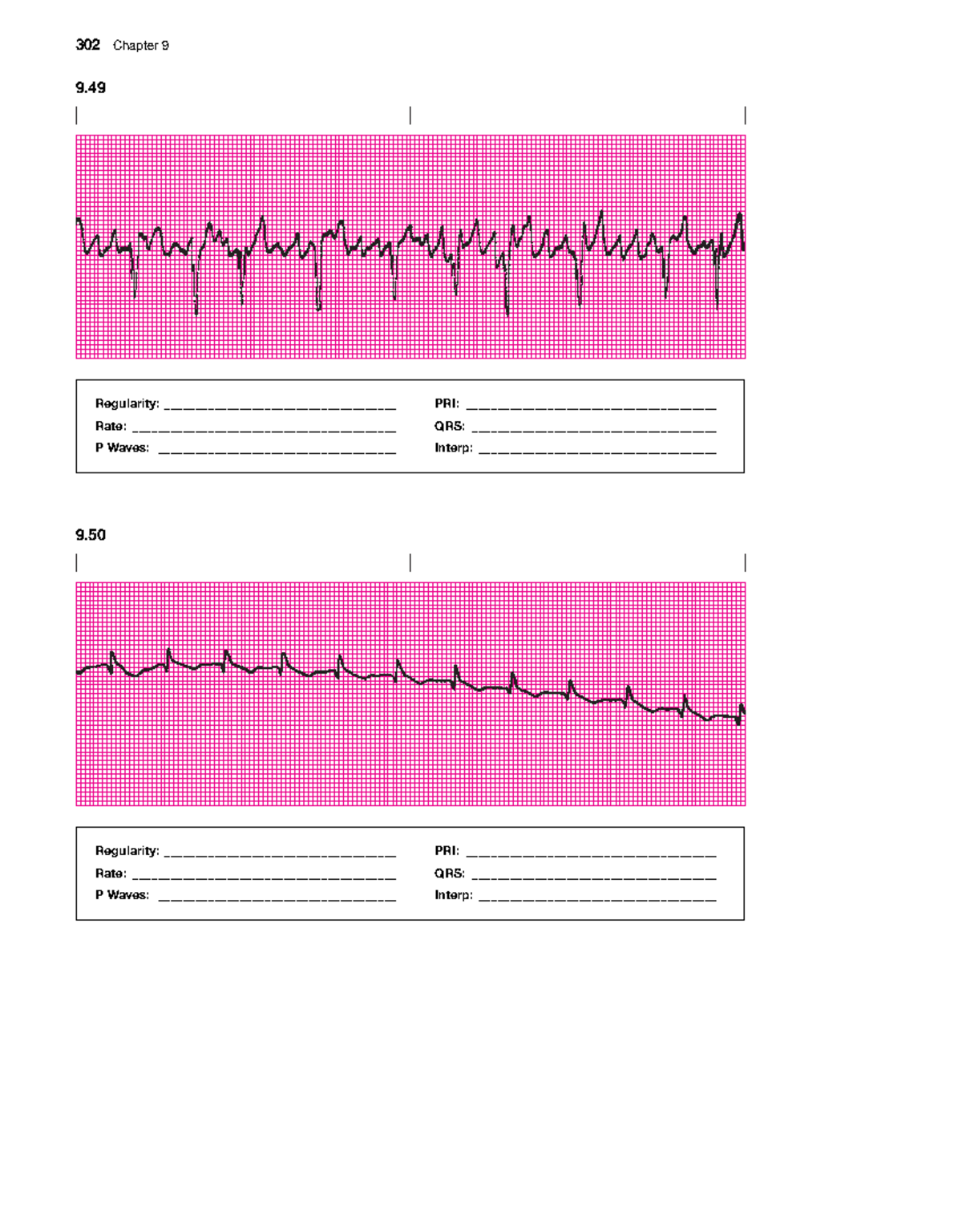 302 Chapter 9 Basic Arrhythmias: Practice & Interpretation Notes - Studocu