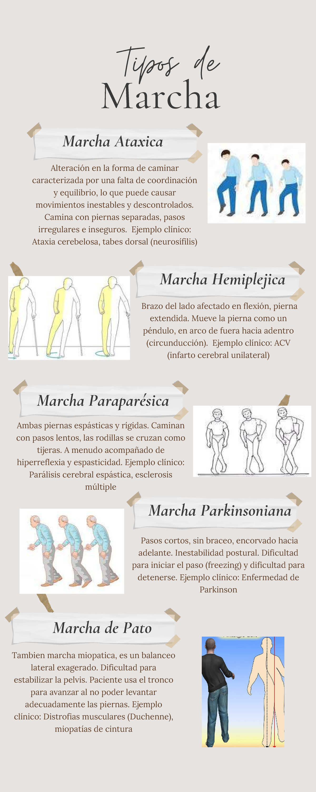 Tipos de Marcha: Análisis Clínico y Ejemplos de Alteraciones - Studocu