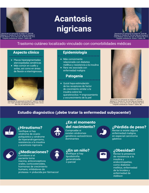 Criterios diagnósticos para dermatitis atípica - Cuadro Criterios de ...