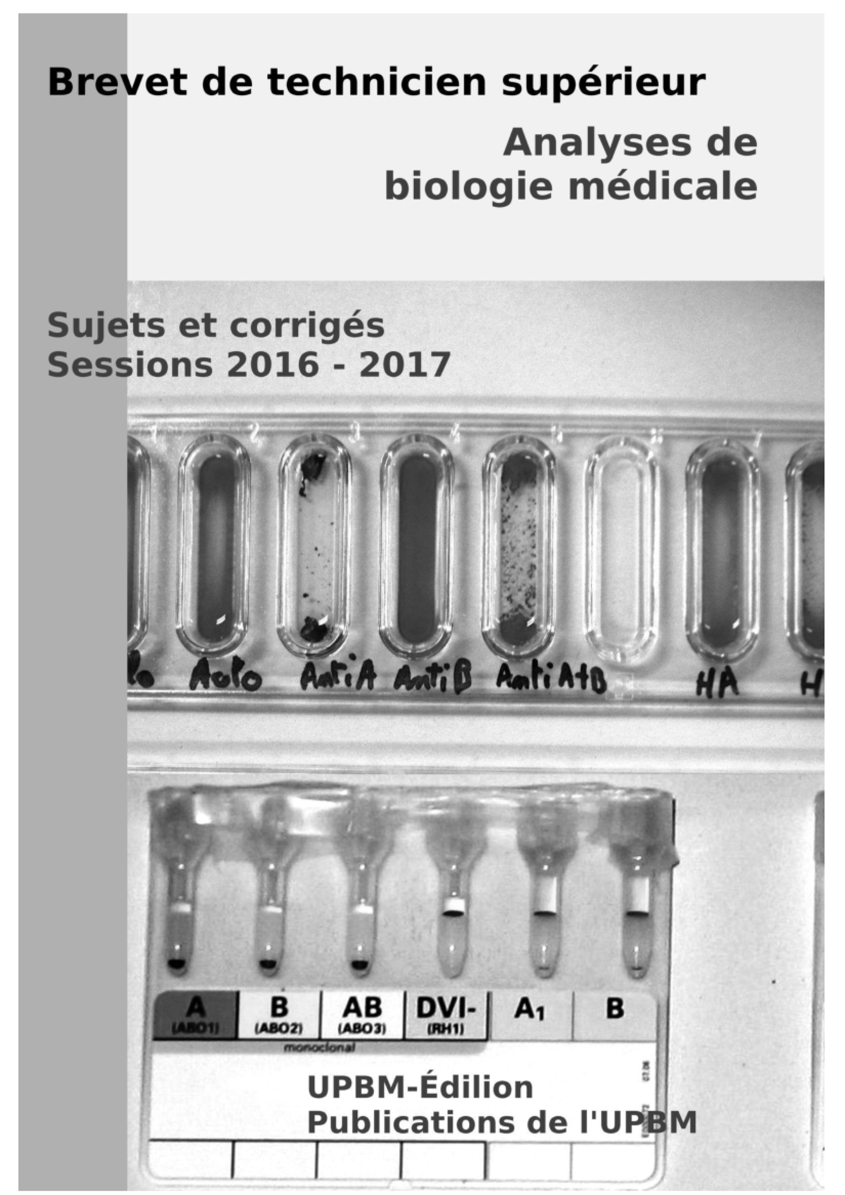 Annales BTS ABM 2016-2017 : Corrigés et Épreuves Théoriques - Studocu