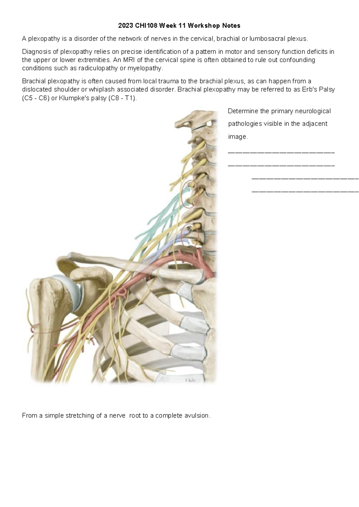 CHI108 Week 11 Tutorial: Understanding Plexopathy & Joint Anatomy - Studocu