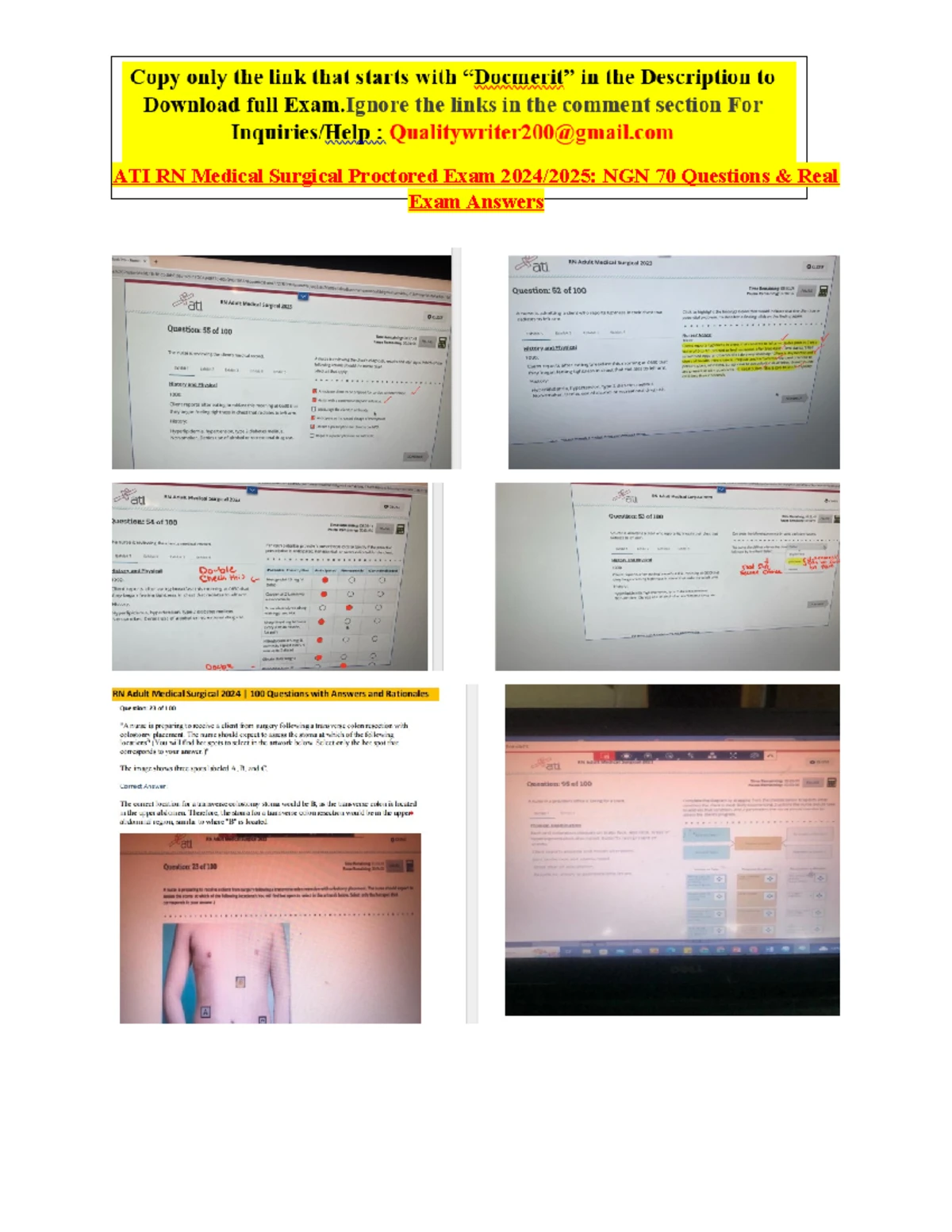 Verified ATI TEAS 7 All Subjects Full 2025 Exam Bundle (2023-2025) 100% Correct Reading, Science ...