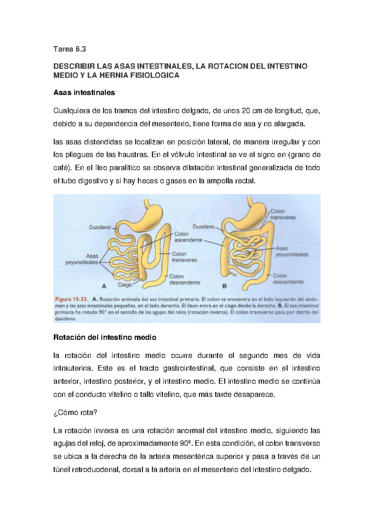 Tarwa 6.3: Asas Intestinales, Rotación Inestinal y Hernia Fisiológica ...