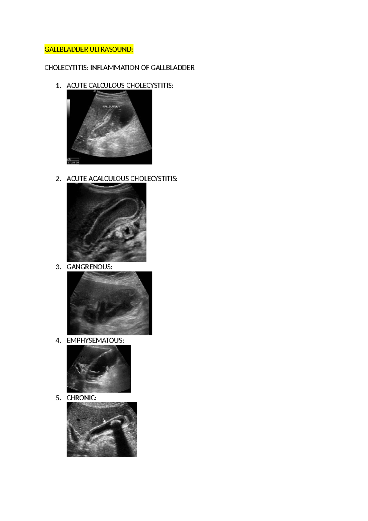 Gallbladder Ultrasound Overview: Cholecystitis & Hepatic Conditions ...