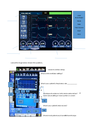 DKA Pathoflow Sheet - Studocu