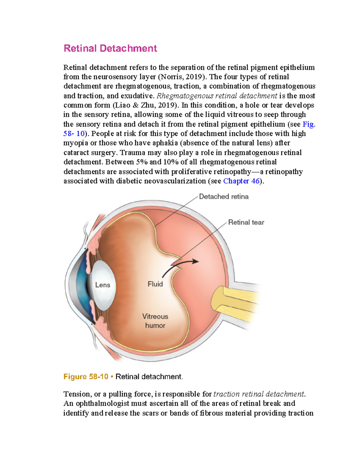 Retinal Detachment: Types, Symptoms, Diagnosis & Management - Studocu