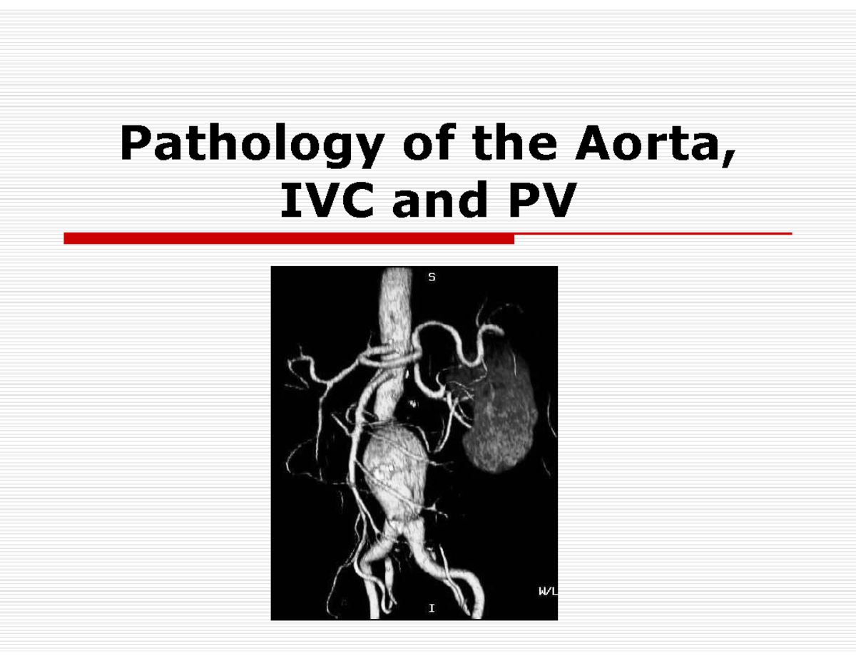 Pathology of Aorta, IVC & PV: Aneurysms & Arteriosclerosis Insights ...