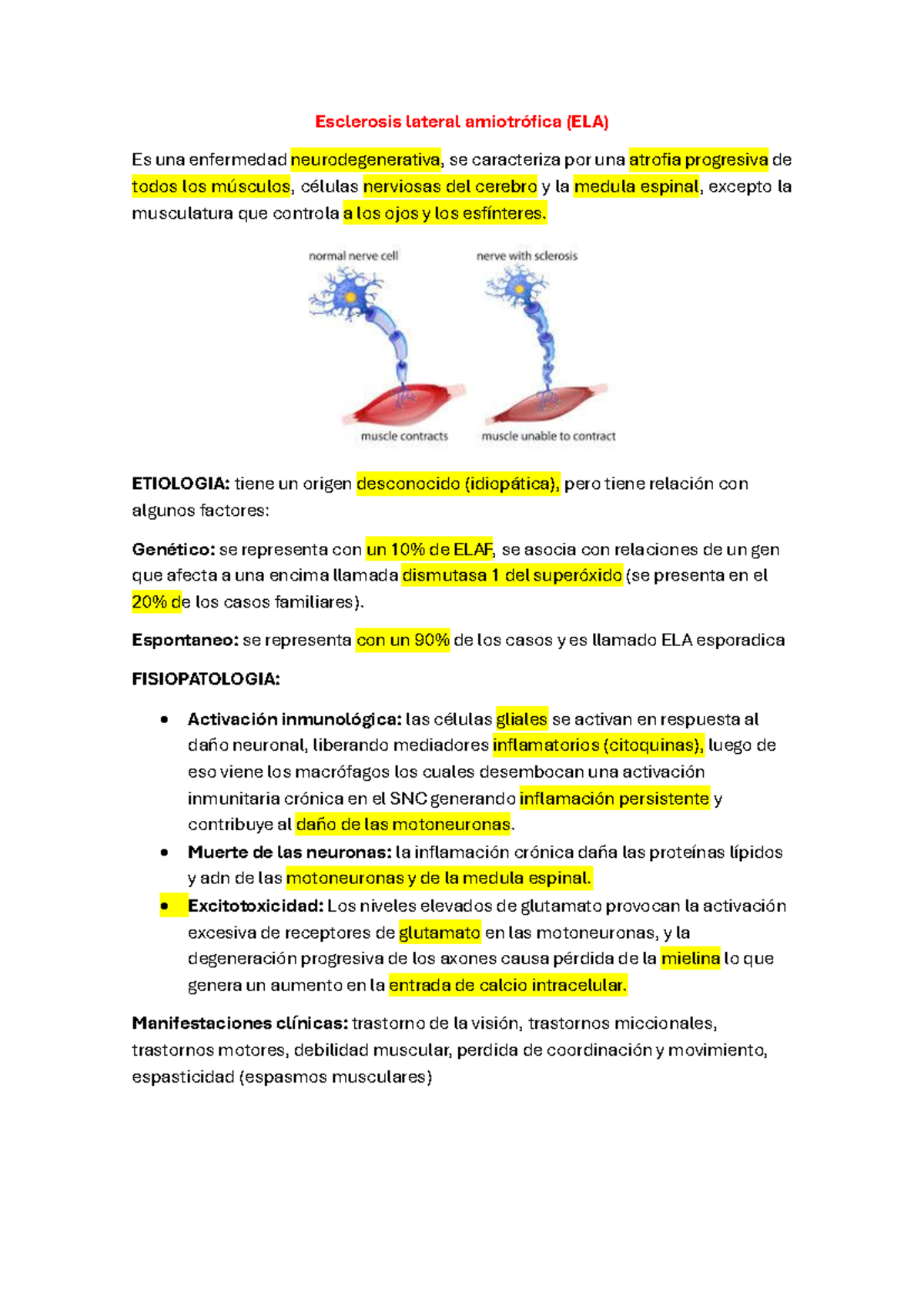 Esclerosis lateral amiotrófica - Esclerosis lateral amiotrófica (ELA ...