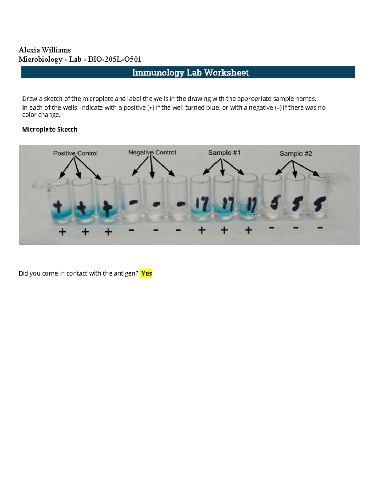 Immunology Lab Worksheet - BIO-205L-O - Alexia Williams - Studocu