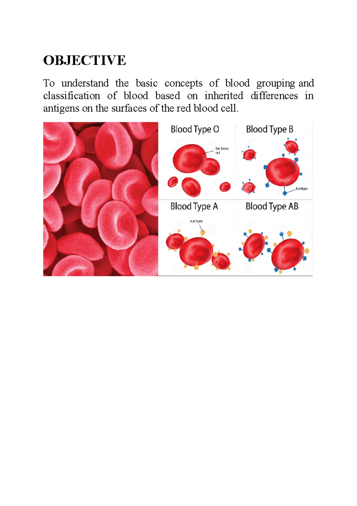 ABO Blood Grouping: Understanding Antigens and Donation Systems - Studocu