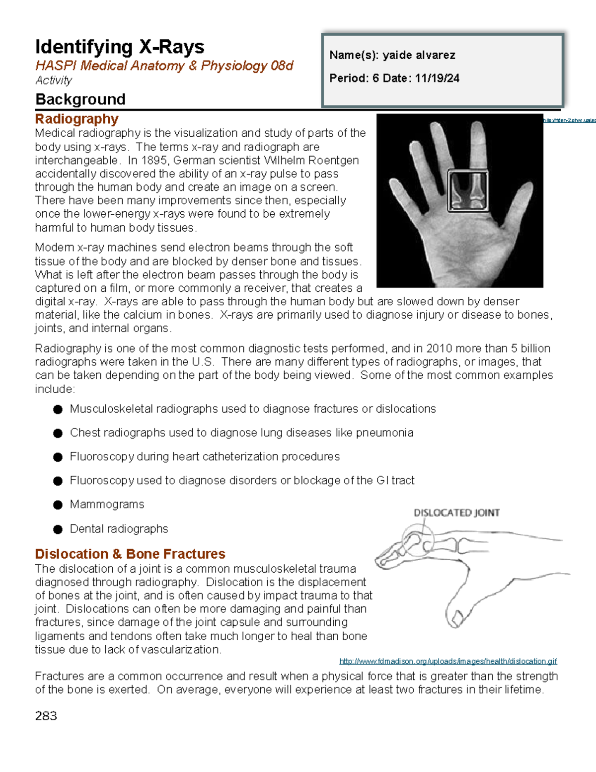 Copy of Haspi Identifying x-rays - Identifying X-Rays HASPI Medical ...
