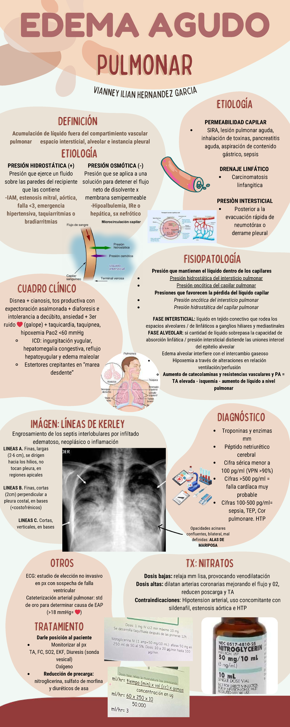 Edema Agudo Pulmonar: Definición, Etiología y Diagnóstico - Studocu
