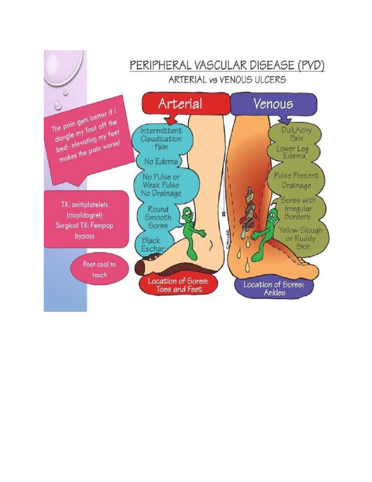PVD Arterial vs Venous Ulcers: Key Differences & Nursing Insights - Studocu
