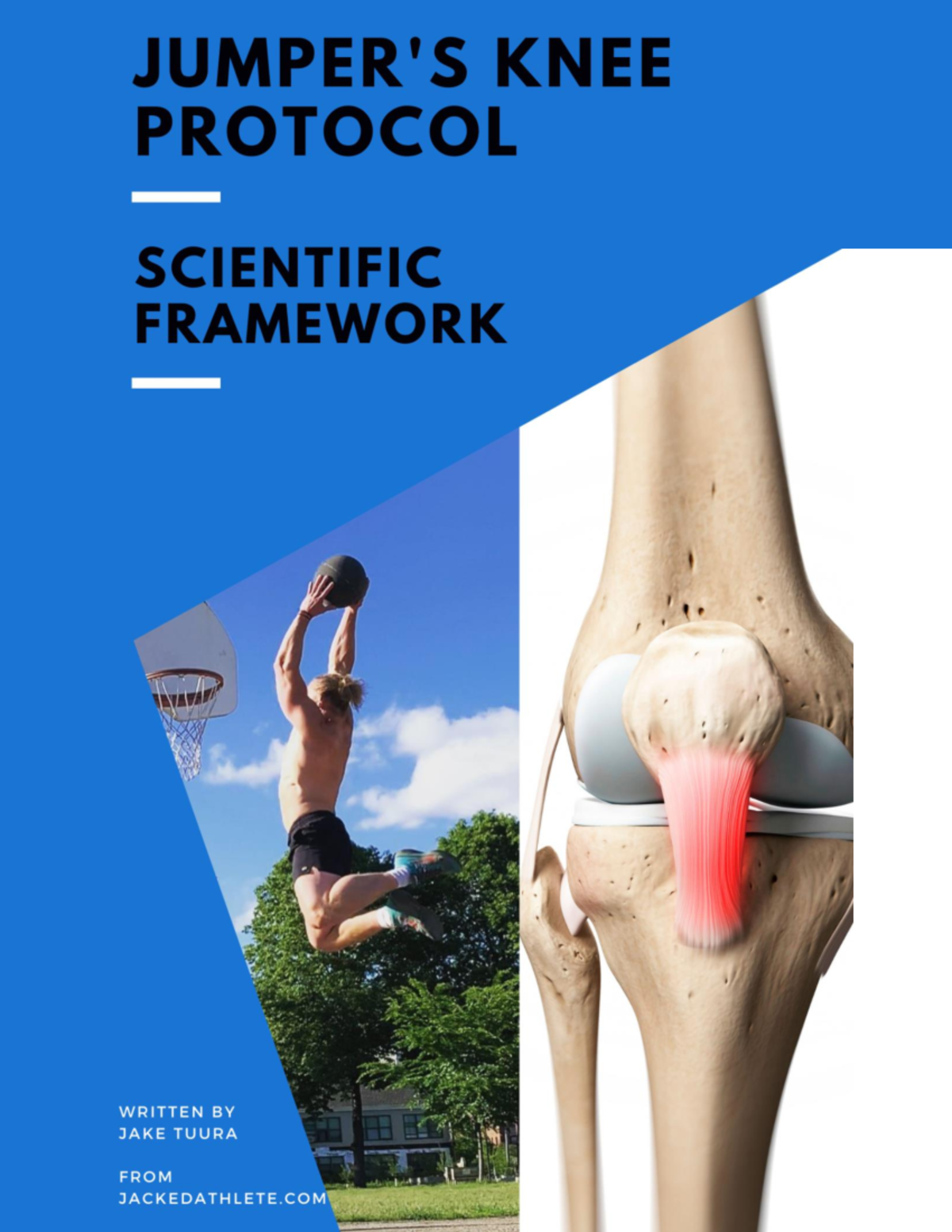 KNEE PROTOCOL: Understanding and Managing Jumper's Knee (861065020 ...