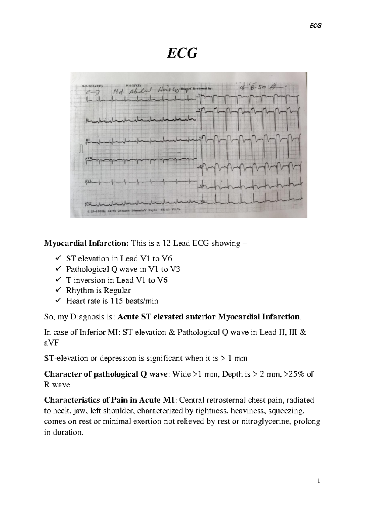 ECG Analysis for Final Prof: Myocardial Infarction & Arrhythmias - Studocu