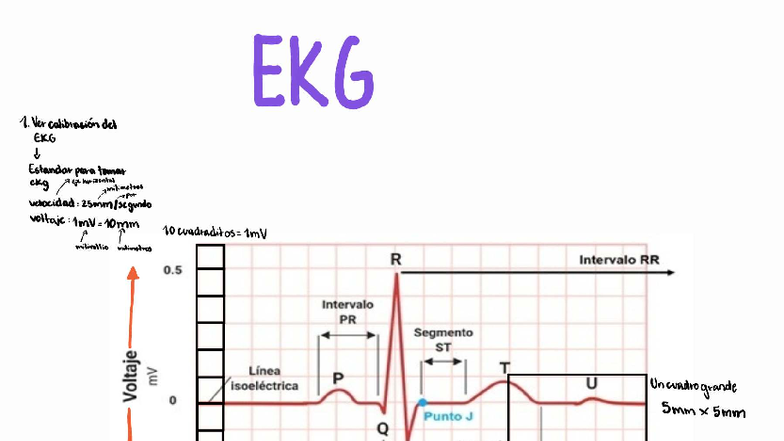 Calibración y Análisis del EKG: Guía Completa EKG 251105 - Studocu