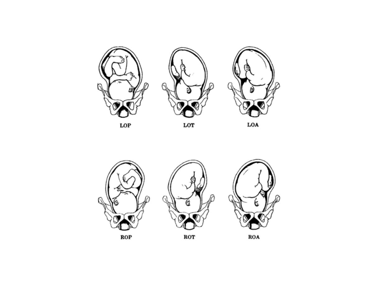 Intrapartum pat2 - Intrapartal part2 - NRST 20209 - 12 Copyright © 2018 ...