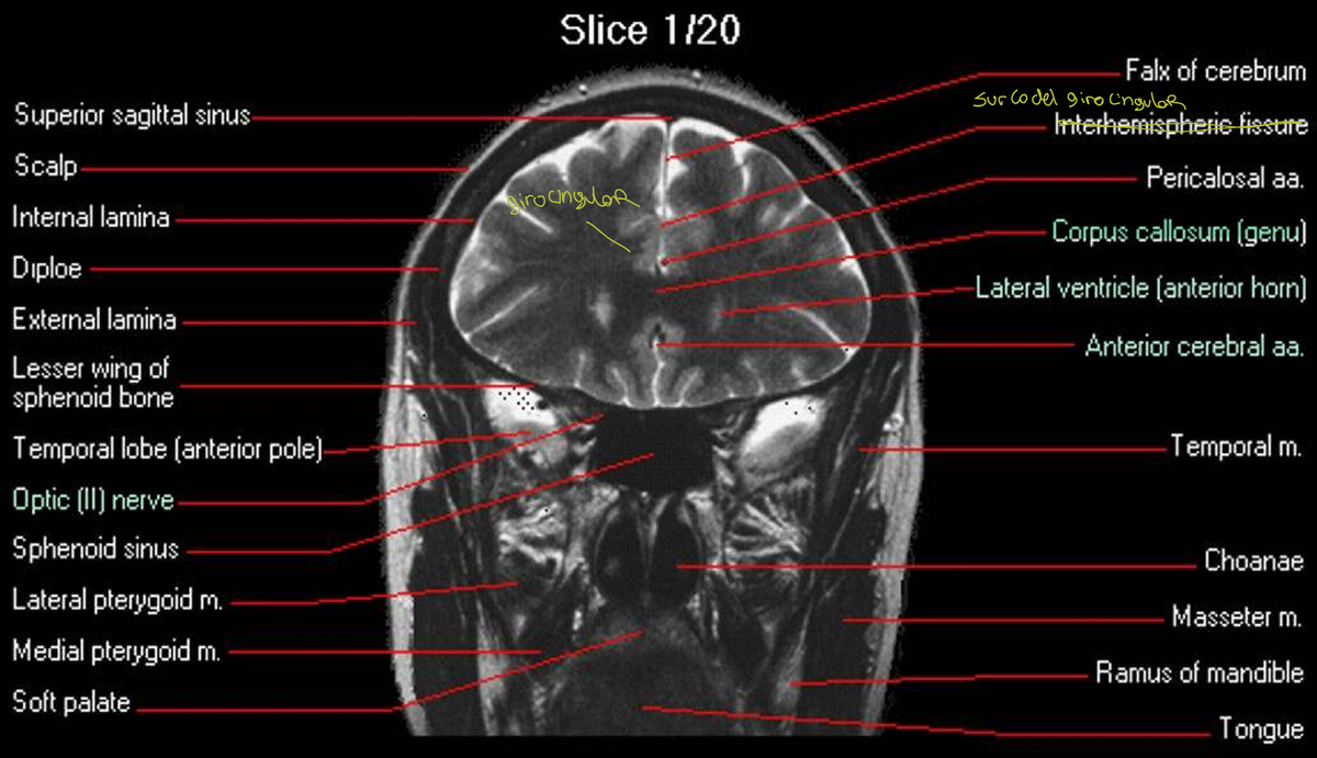 Anatomía Del Giro Cerebral