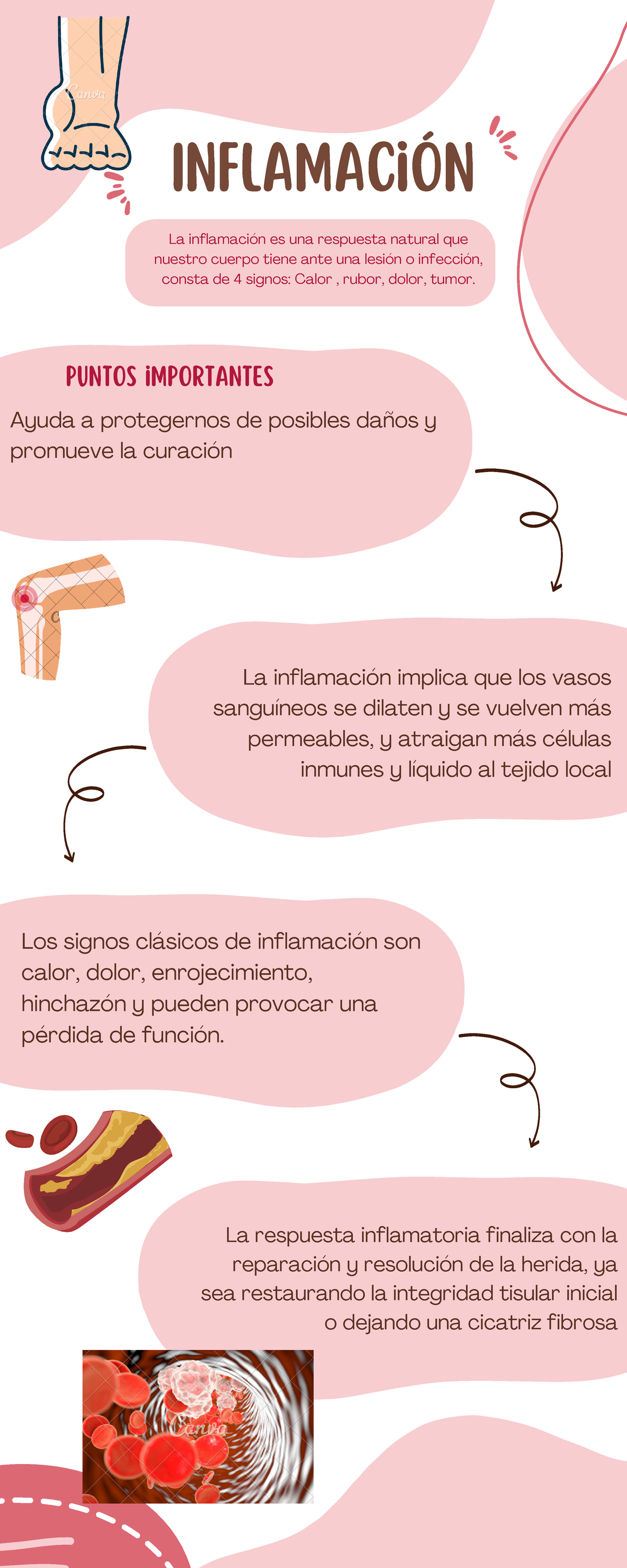 Infografia inflamación - Inflamación La inflamación es una respuesta ...