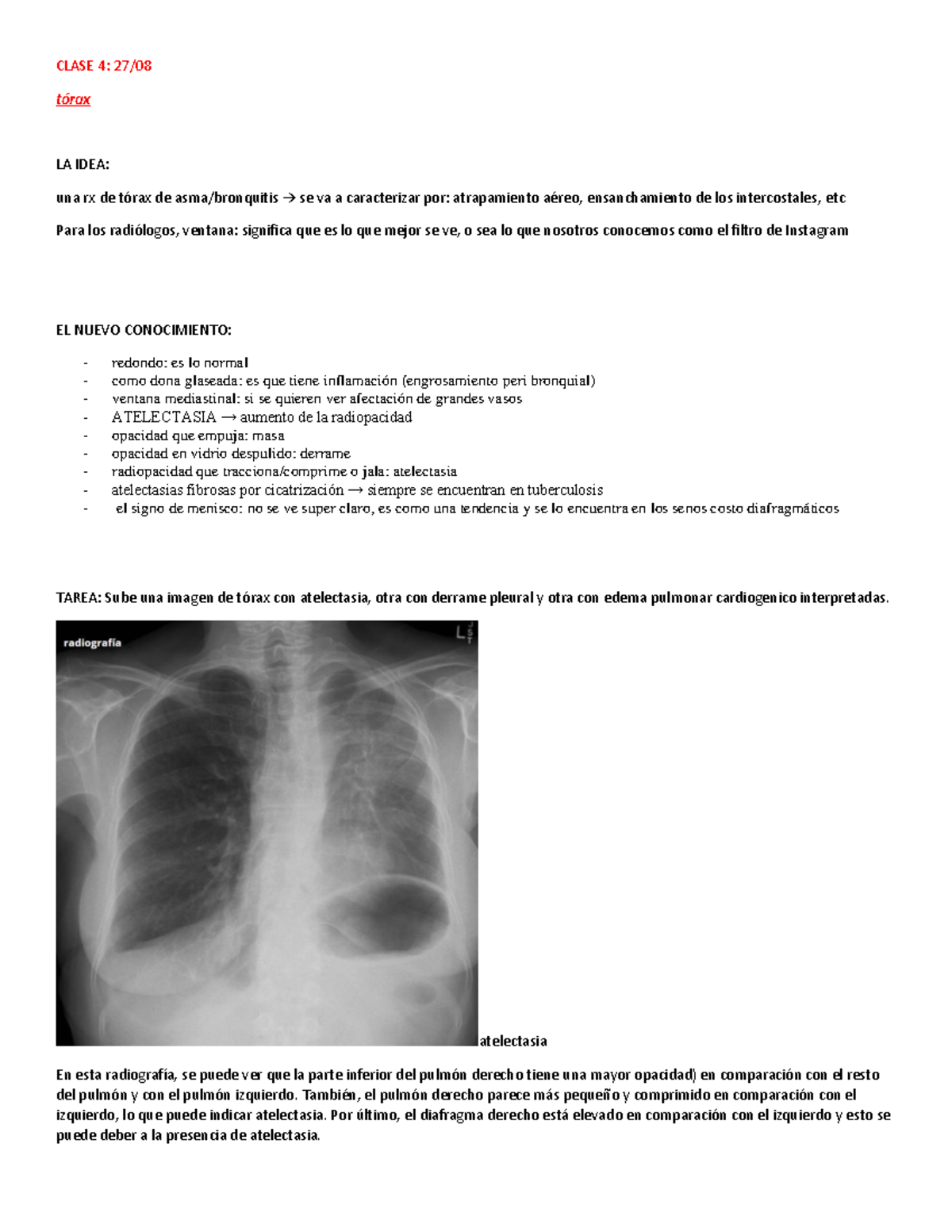 Apuntes clase torax - CLASE 4 : 2 7/ 08 tórax LA IDEA: una rx de tórax ...