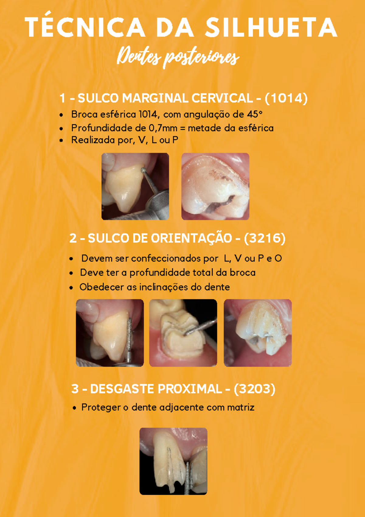 Técnicas de Preparo Protético Manual - COM 1014, 3216, 3203, 2215 - Studocu