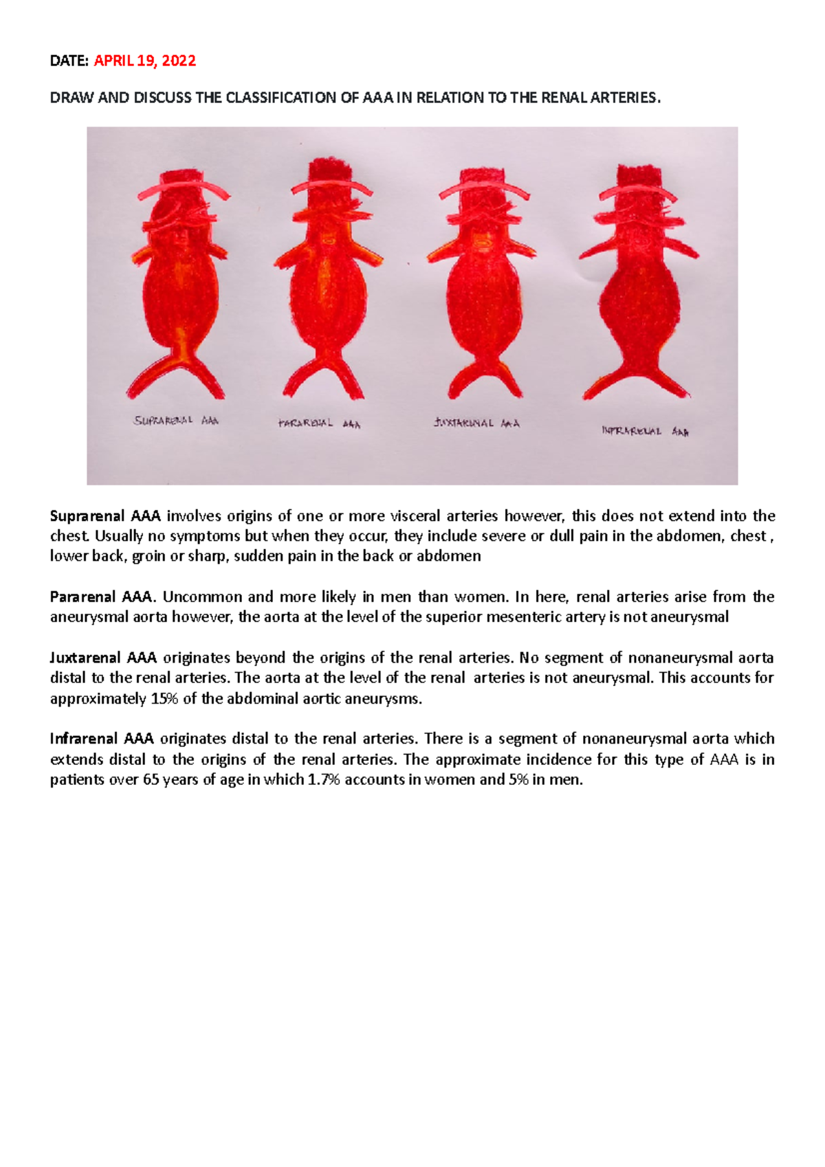 Abdominal Aortic Aneurysm - DATE: APRIL 19, 2022 DRAW AND DISCUSS THE ...