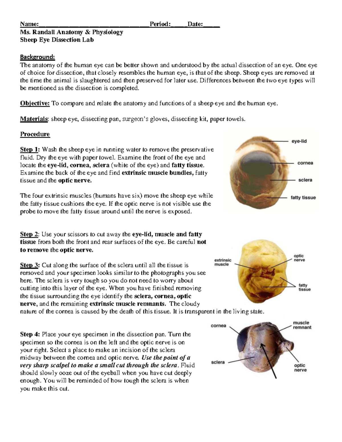 Sheep Eye Dissection Lab Procedures for A&P (Course Code) - Studocu