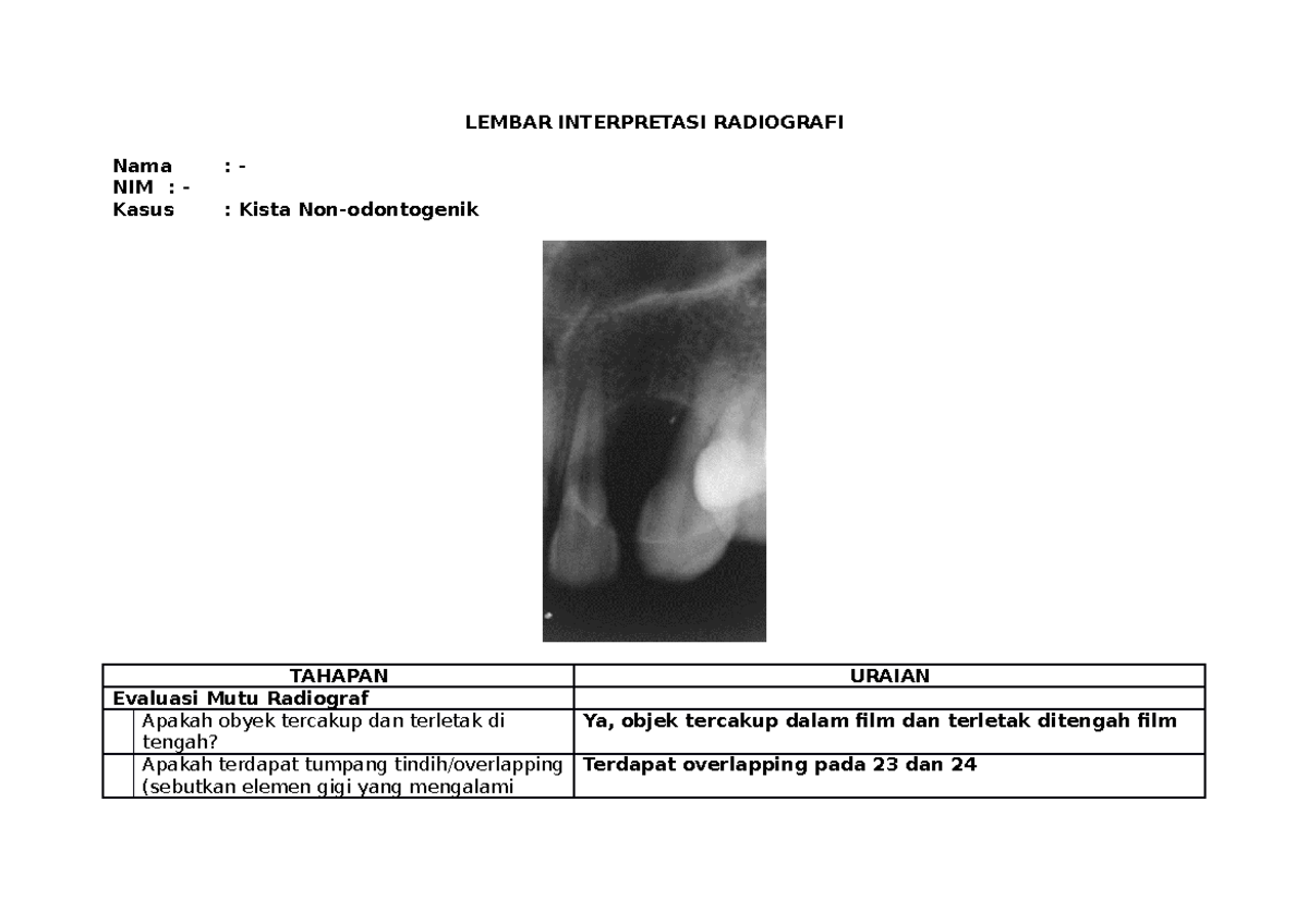 Interpretasi Radiografi Kista Non-Odontogenik: Analisis Kasus 2 - Studocu