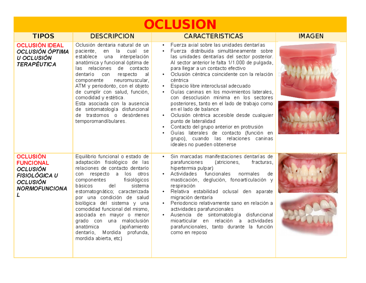Tipos de Oclusión: Descripción y Características Clínicas - Studocu