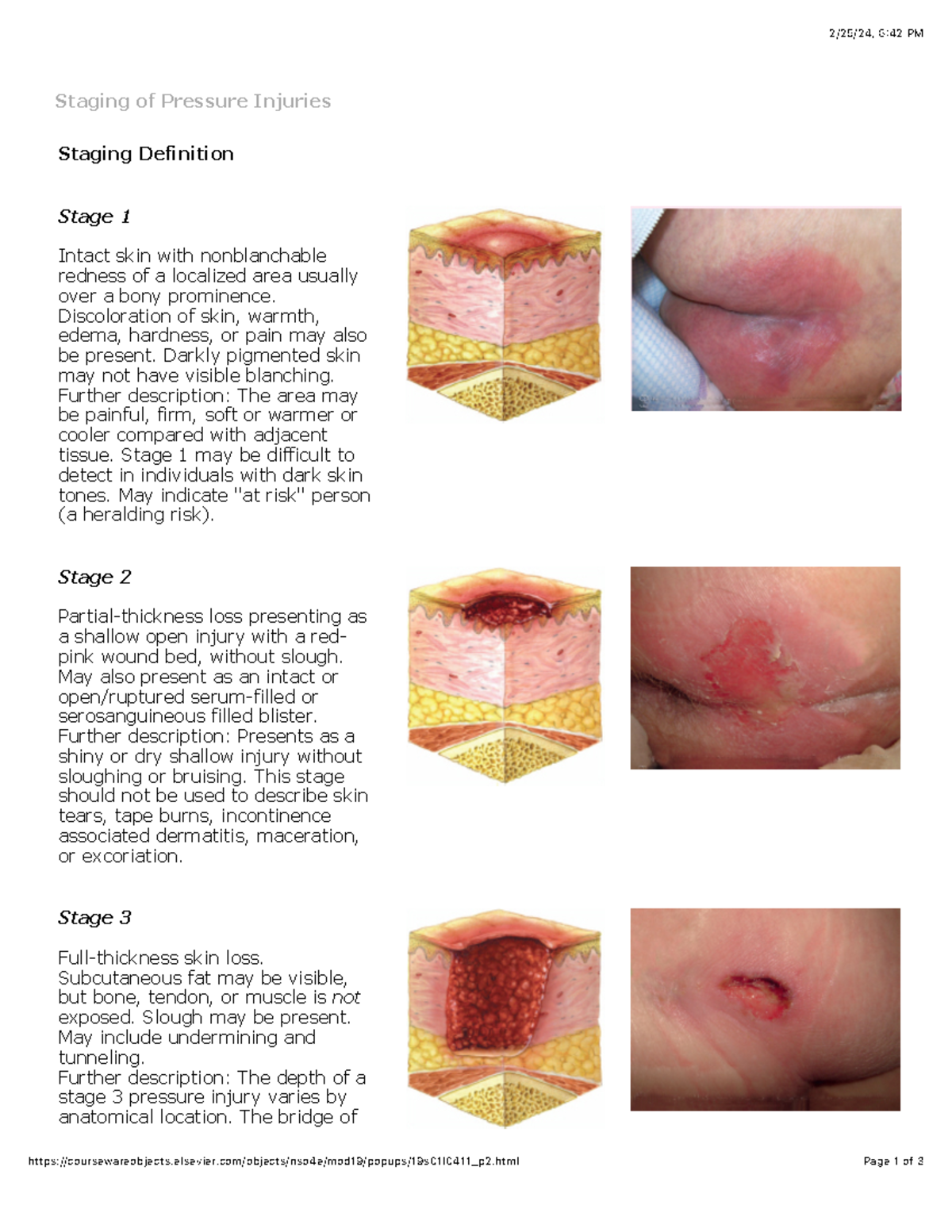 Pressure Injuries Staging Guide - Charts & Images (MEDI 201) - Studocu