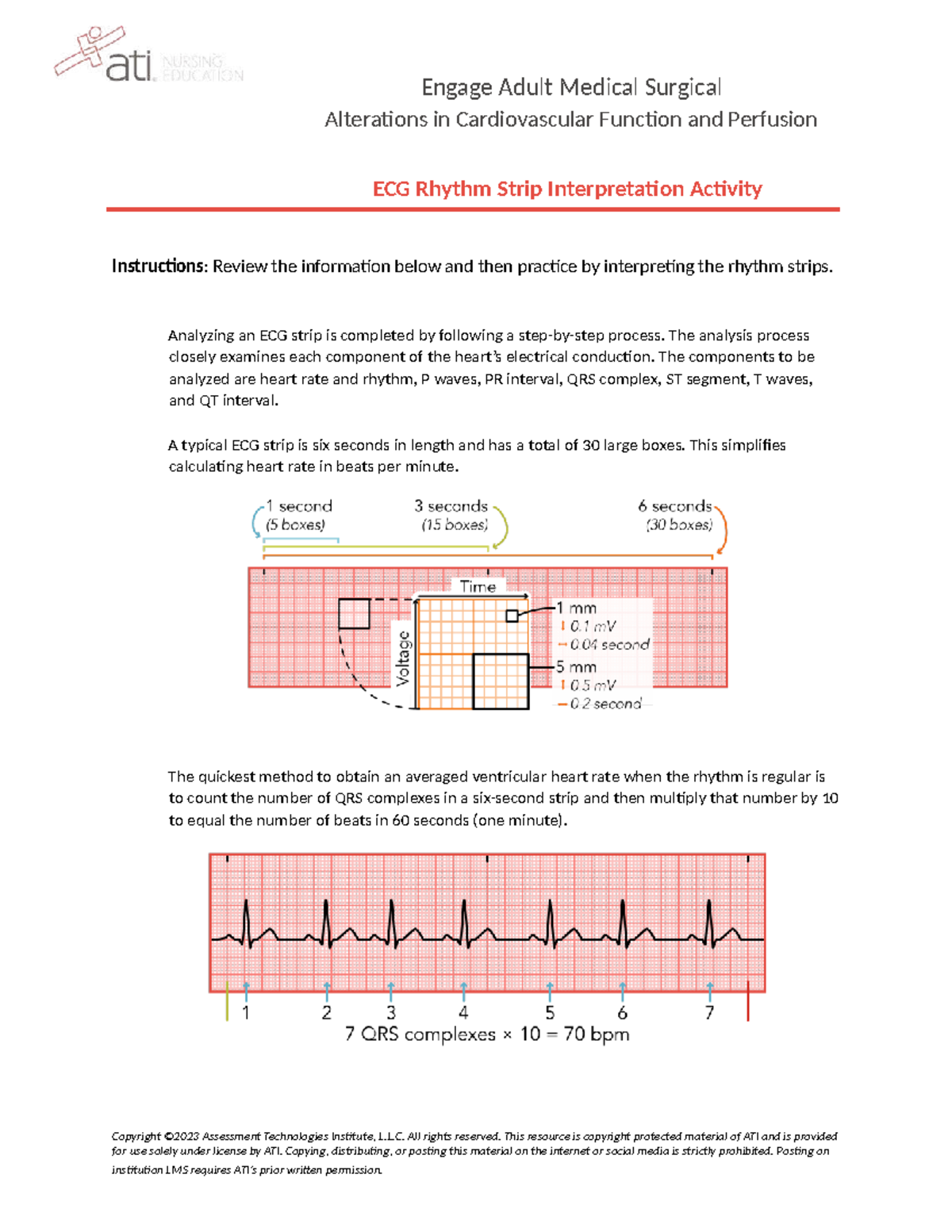 ECG Rhythm Strip Interpretation Activity for Adult Med-Surg (NURS 101 ...