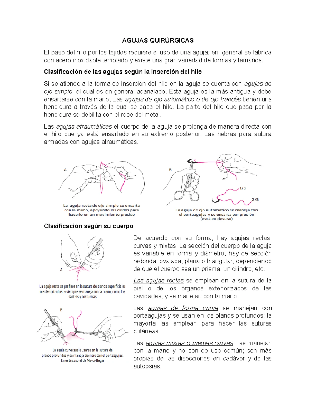Suturas X y Z: Técnica y Tiempo de Aplicación en Urgencias - Studocu