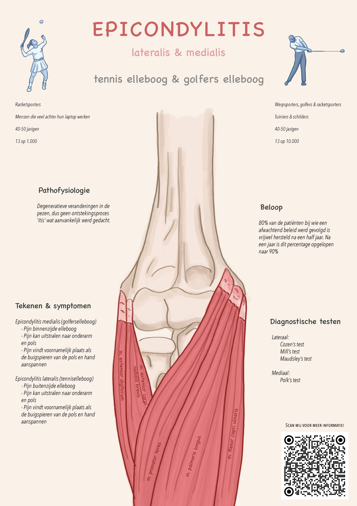 Studie over Epicondylitis Lateralis en Medialis: Bij Tennis en Golf ...