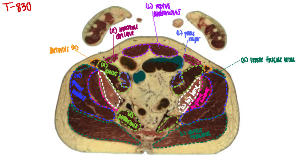 VHDs - Cross Sections of Abdominal and Lower Extremity Anatomy - Studocu
