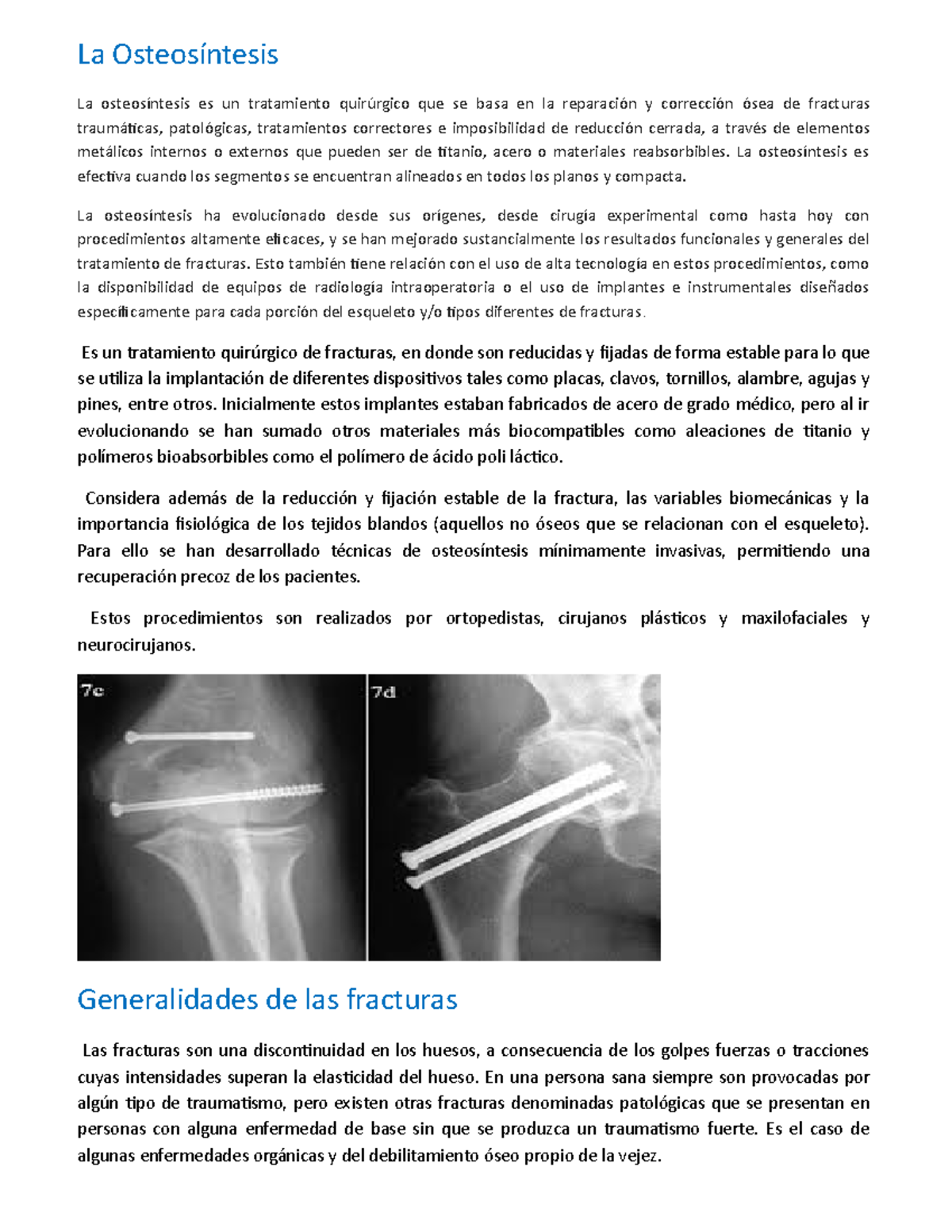 La Osteosintesis - La Osteosíntesis La osteosíntesis es un tratamiento ...