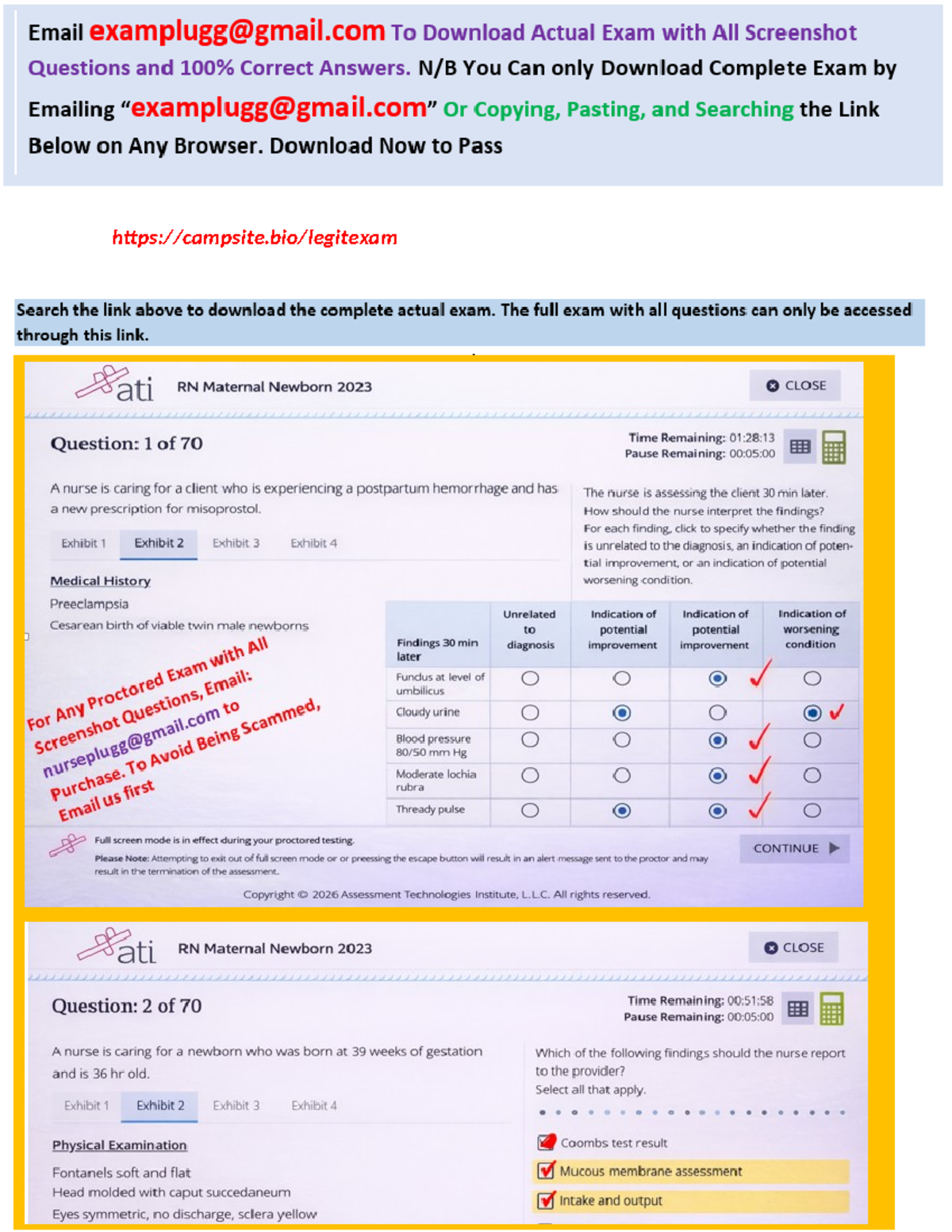 Latest ATI RN Maternal Newborn 2023-2026 Proctored Exam: 70 Q&A - Studocu