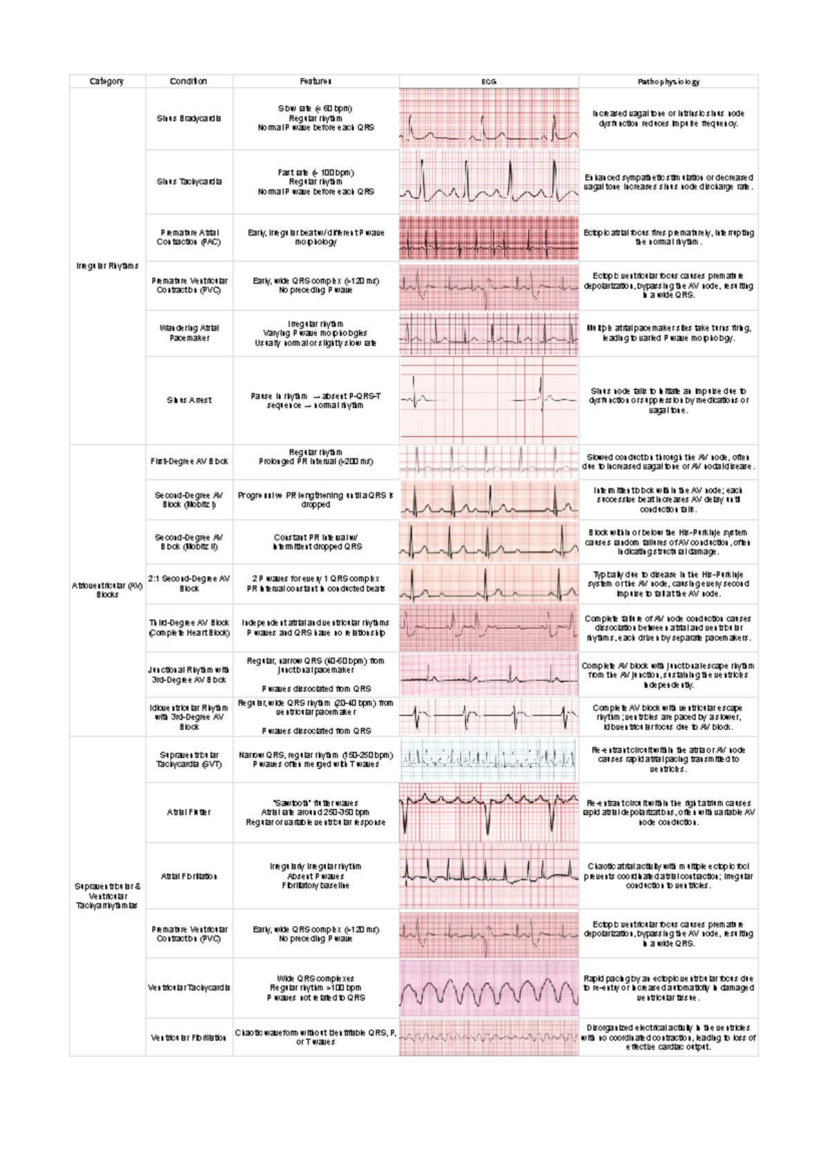 ECG Quick Sheets: Pathophysiology of Cardiac Conditions - Studocu