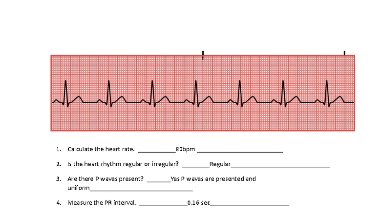 ADN181 ECG Rhythm Analysis Practice Guide - Studocu