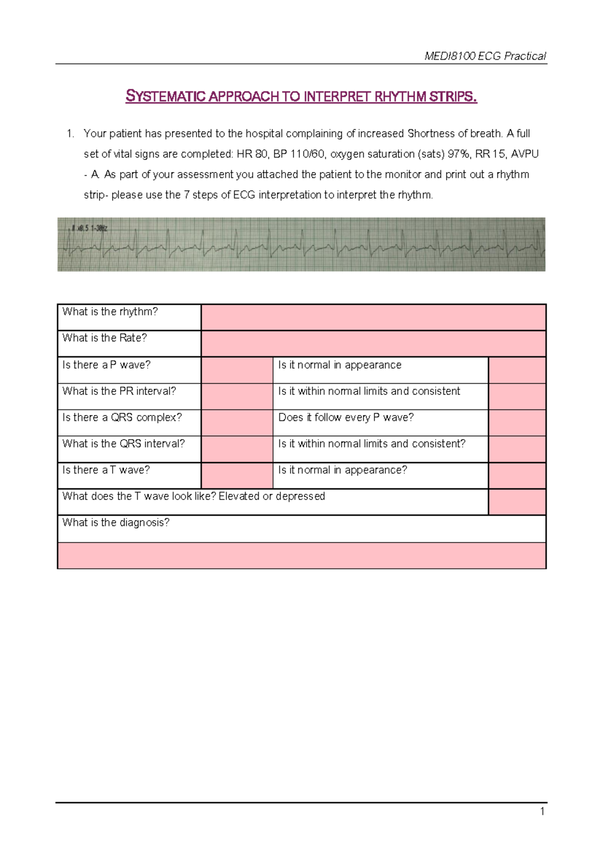 Common ECG Presentations - Interpretation Worksheet - Studocu