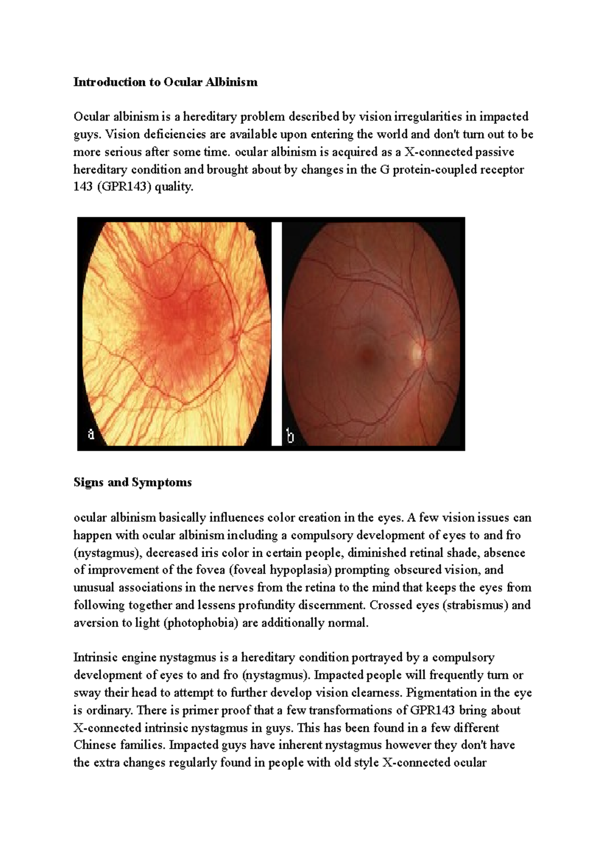 Ocular Albinism: Understanding Genetics, Symptoms & Related Disorders ...