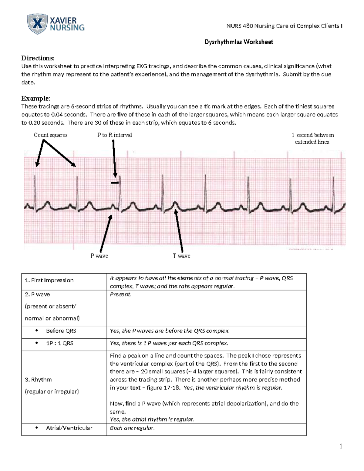 NURS 480 Dysrhythmias Worksheet: EKG Interpretation & Clinical ...
