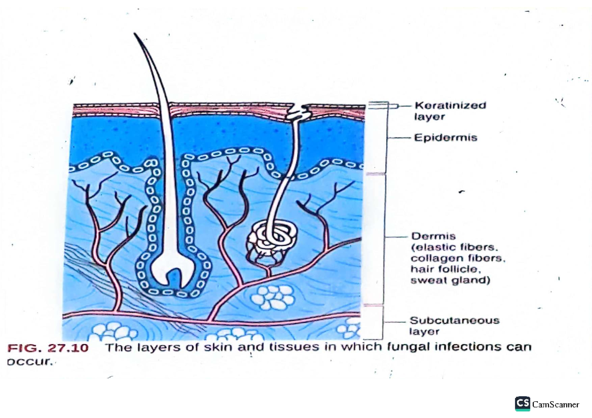 CS Medtech Essentials: Superficial Mycoses and Skin Infections Overview ...
