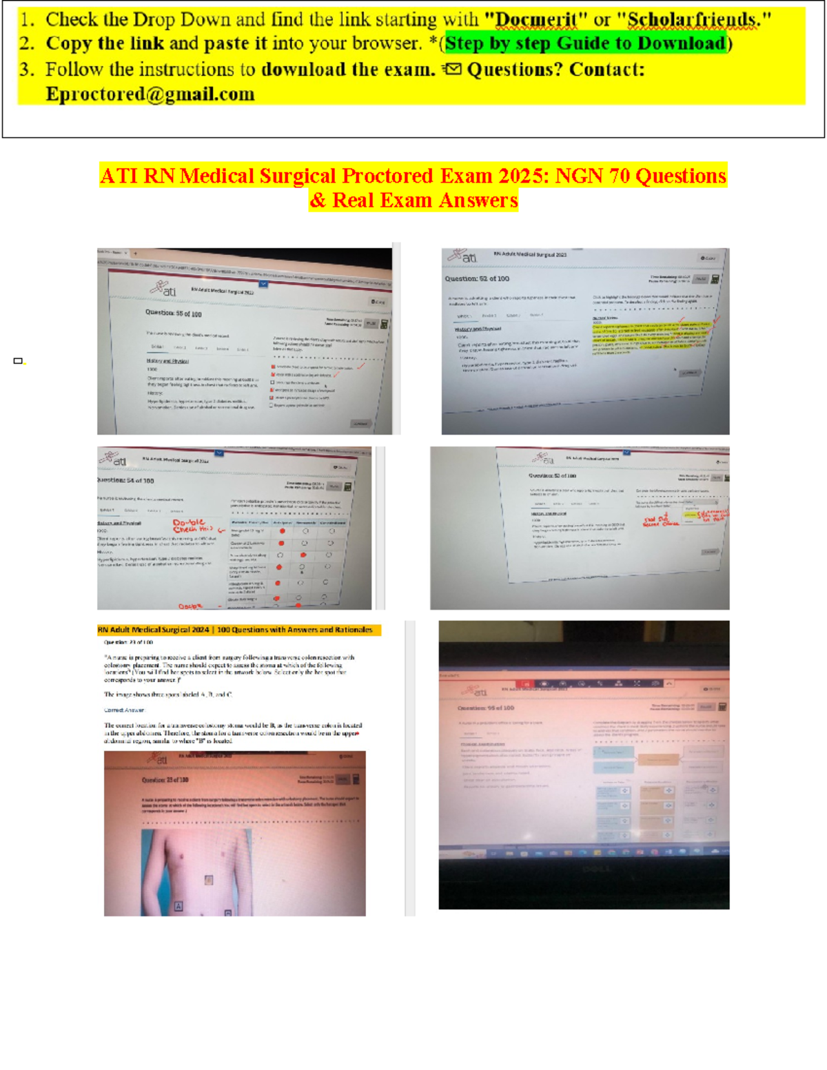 Complete 2023-2025 ATI RN Adult Medical-Surgical Proctored Exam, 100 ...