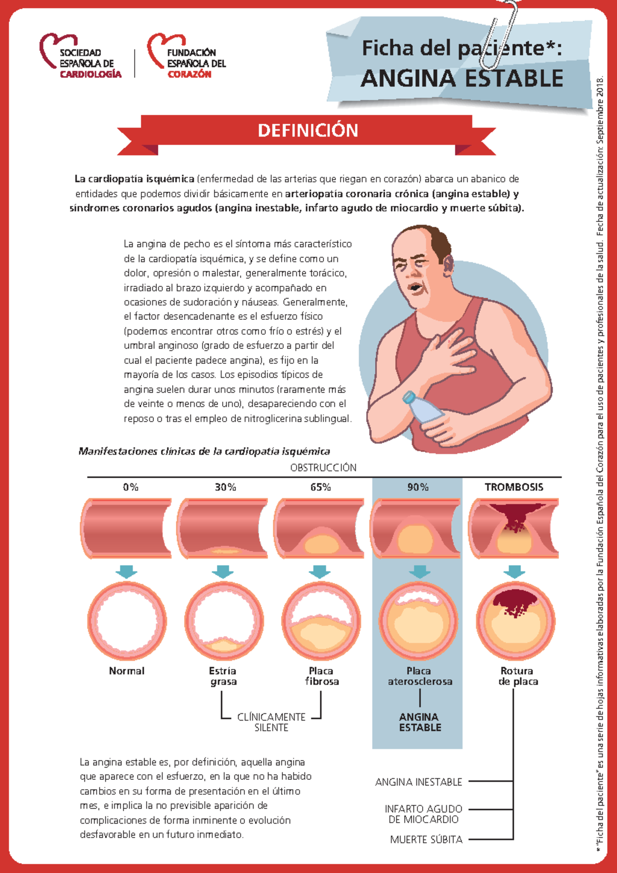 Angina-estable - Resumen de Angina Estable - Ficha del paciente ...