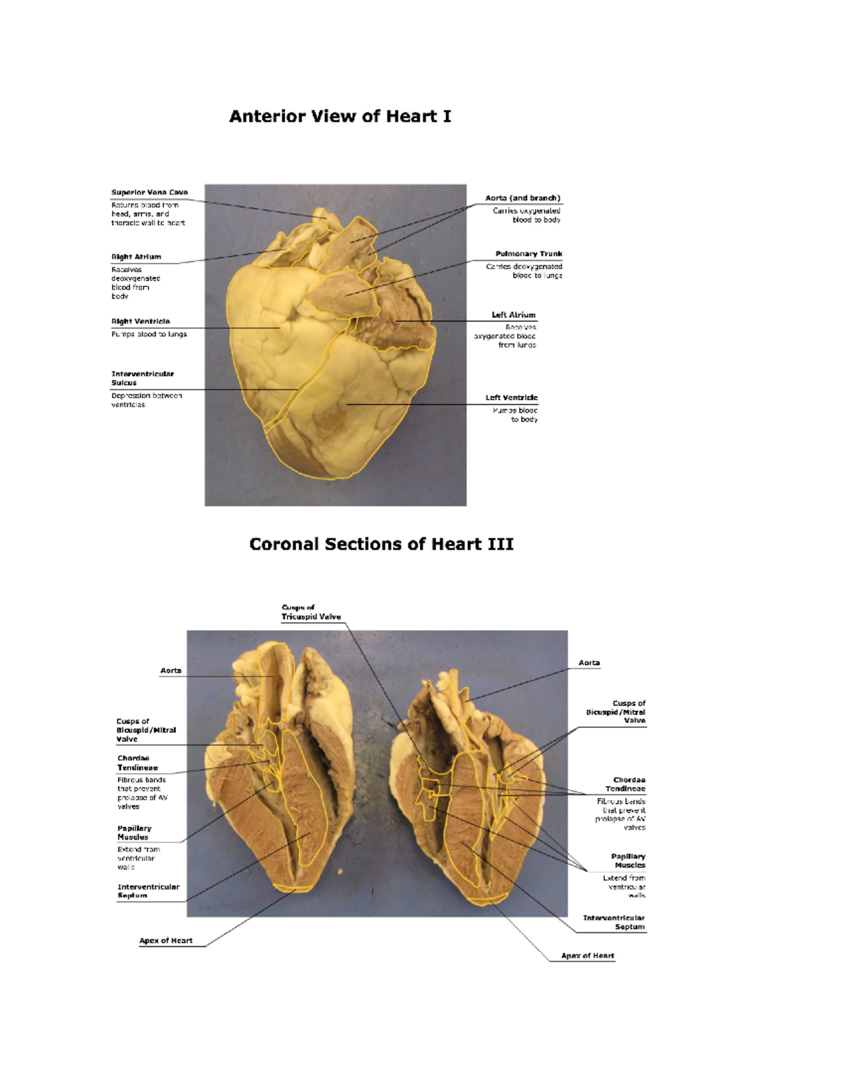 Sheep Heart Anterior View