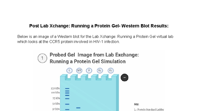 Lab Exchange Running Protein Gel Summer 2020 Post Lab Questions Final ...