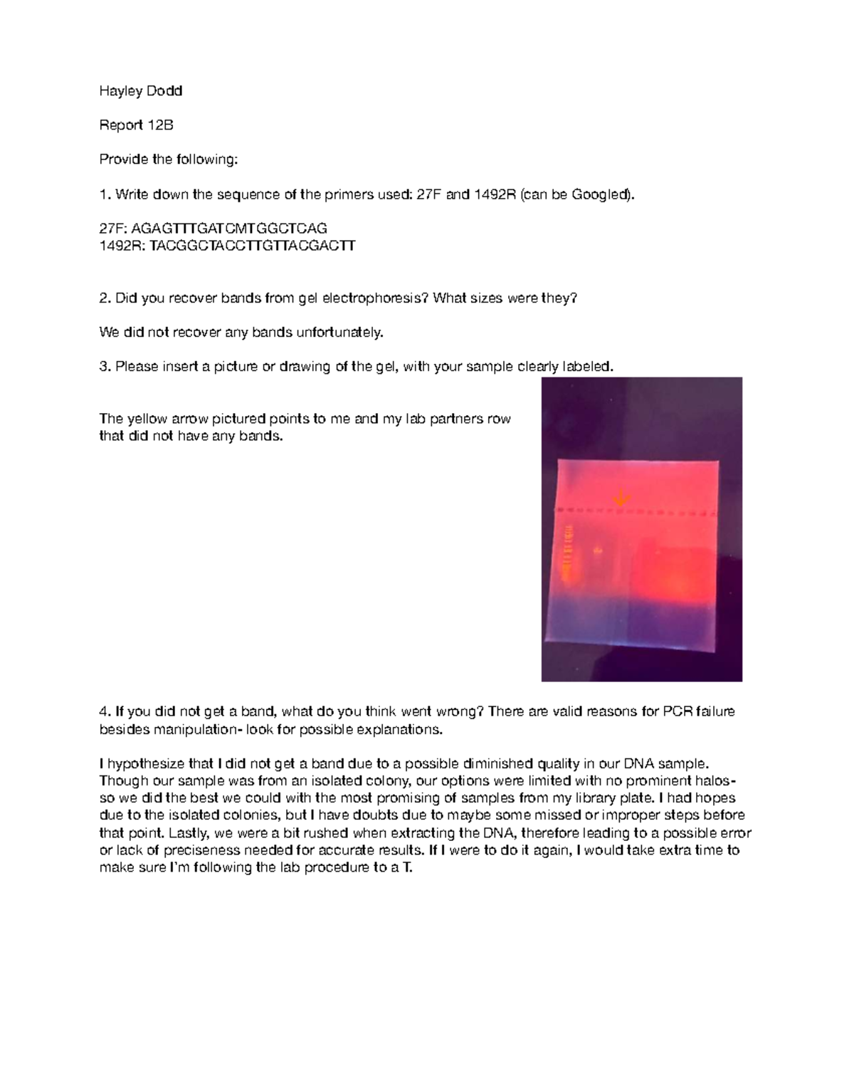 Lab 12B Report: PCR Primer Sequence & Gel Electrophoresis Analysis ...
